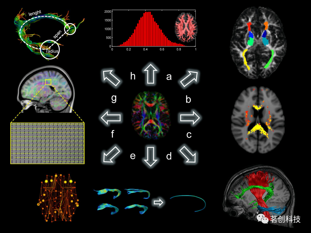 磁共振弥散成像(dMRI)分析方法 - 知乎