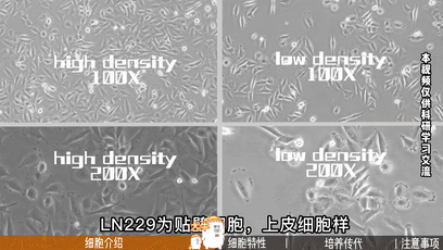 LN229细胞培养，人胶质母细胞瘤细胞培养攻略 - 知乎