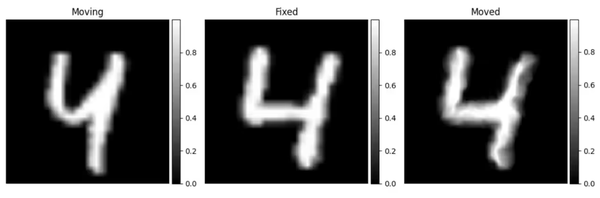 分割图——SynthMorph，零样本学习完成跨模态配准任务 - 知乎