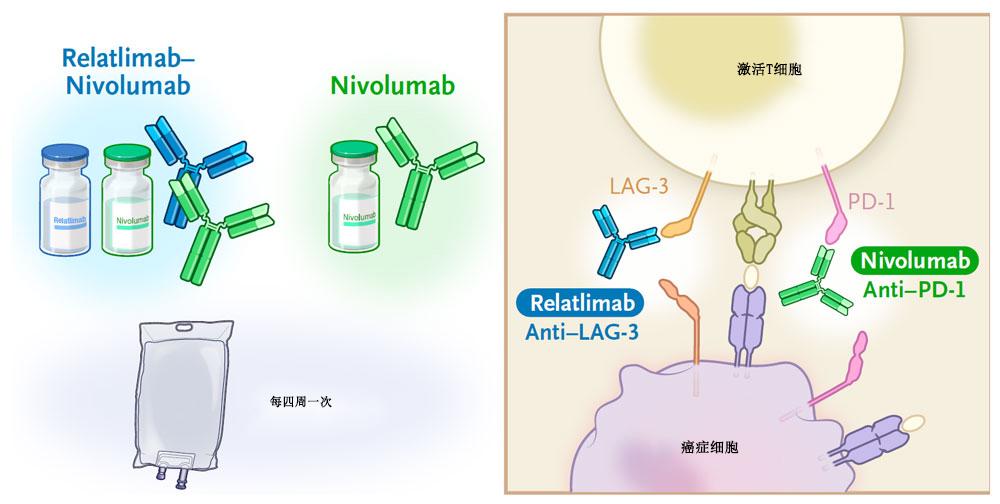 首个LAG-3阻断抗体组合！FDA批准Opdualag用于治疗12岁及以上黑色素瘤 - 知乎