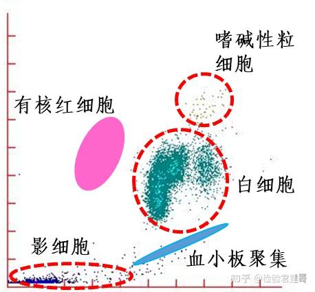 血常规散点图和直方图不会看？1 分钟看懂 12 种异常结果 - 知乎