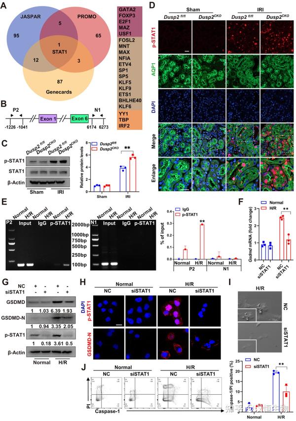 Theranostics | 急性肾损伤治疗策略 - 知乎