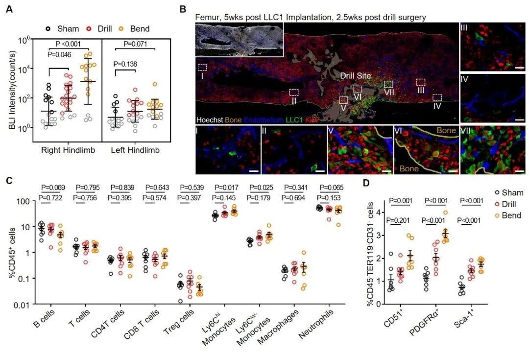 Cancer Discov︱张翔团队报道NG2+基质细胞在骨重塑和转移起始中的特殊作用 - 知乎