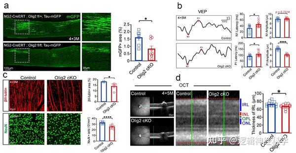 J Neurosci︱梅峰/叶剑课题组揭示老化过程中少突胶质细胞更替不足是导致视神经轴突退化和视功能下降的重要原因 - 知乎