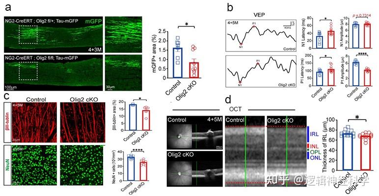 J Neurosci︱梅峰/叶剑课题组揭示老化过程中少突胶质细胞更替不足是导致视神经轴突退化和视功能下降的重要原因 - 知乎