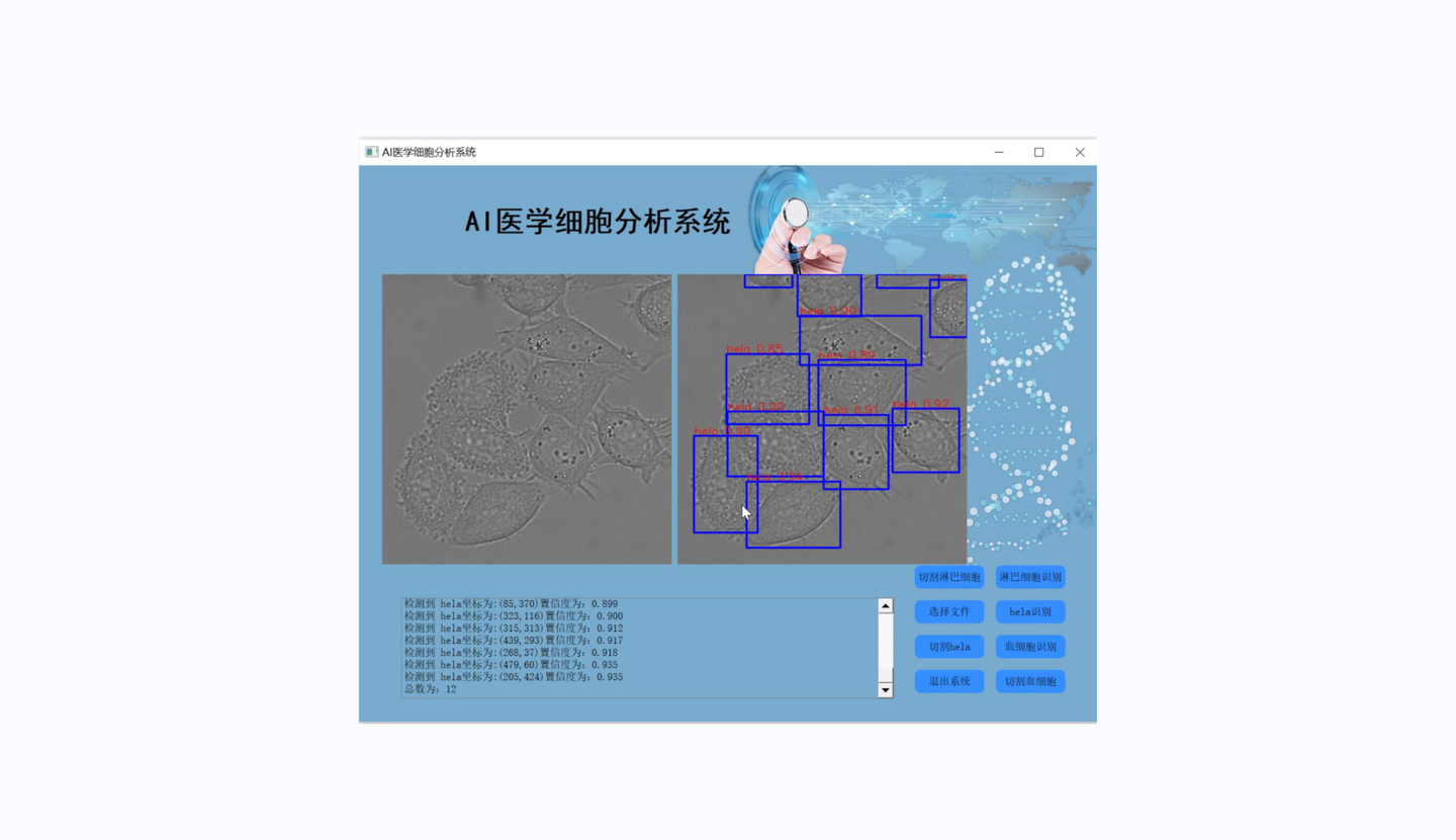 Python基于yolov7的显微镜下细胞识别&分割系统源码&部署教程&数据集 知乎