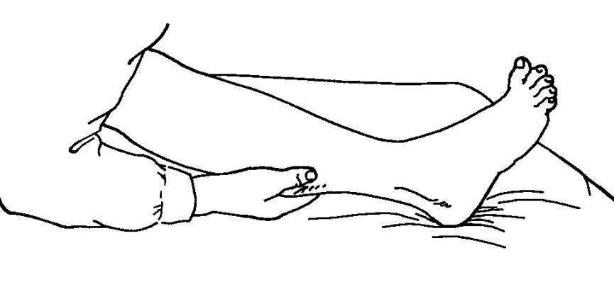巴宾斯基（Babinski）征怎么查 - 知乎