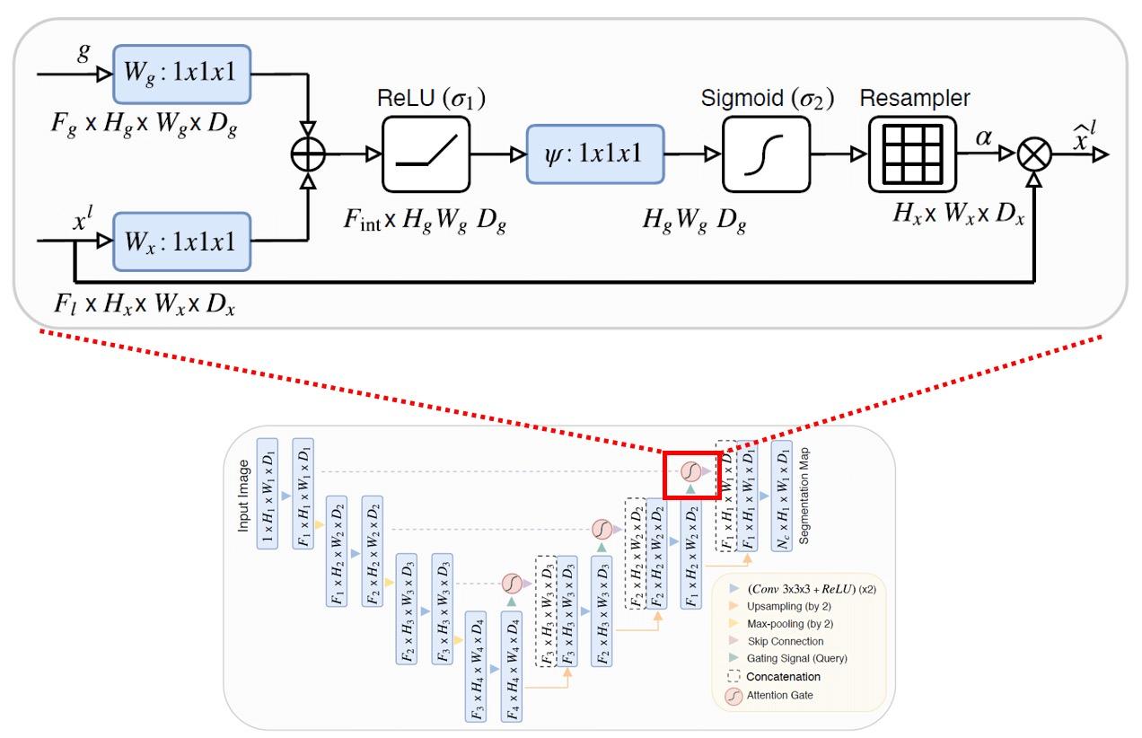Attention-UNet学习笔记 - 知乎