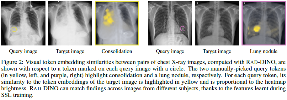 （2025|Nature Machine Intelligence|微软&剑桥，医疗影像编码器、RAD-DINO、自监督学习） - 知乎