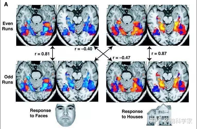 如何观察我们的大脑？脑检测技术盘点 - 知乎