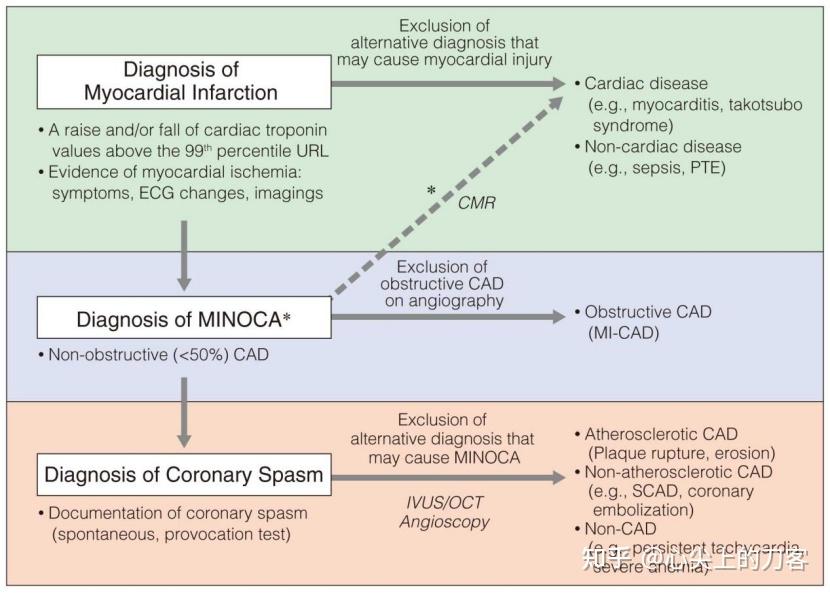 冠脉非阻塞性心梗（MINOCA）仅仅是临时诊断，应进一步查因！日本冠脉痉挛和冠脉微血管功能障碍指南 - 知乎