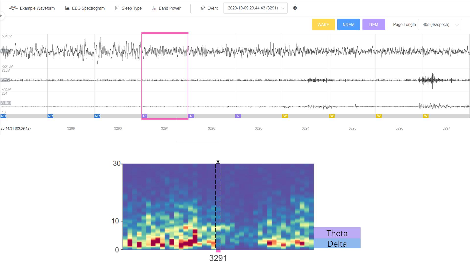 【Lunion Stage】如何使用频谱图提高睡眠分析效率 - 知乎