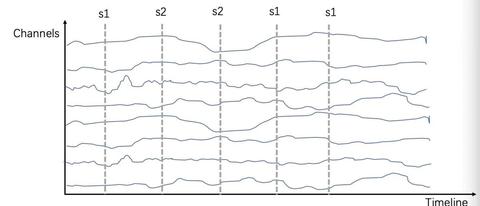 Python-MNE:半自动脑电预处理 - 知乎