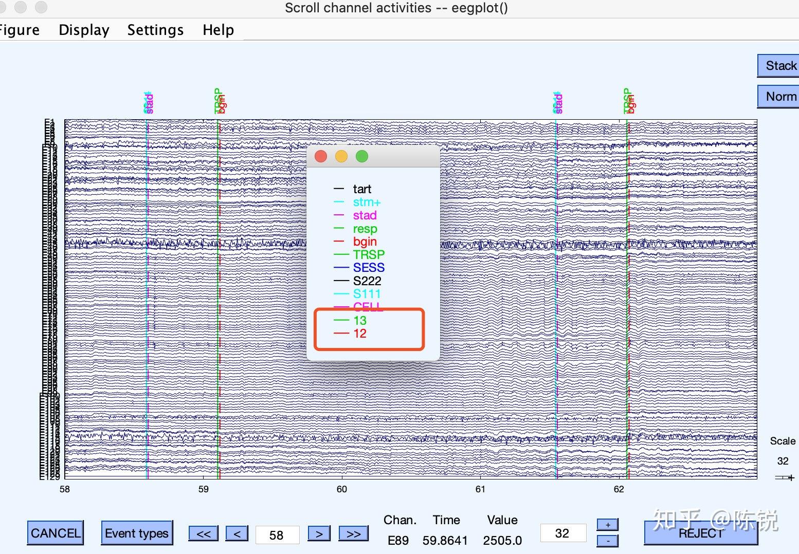 如何使用Netstation修改marker（基于EGI设备数据格式.mff） - 知乎