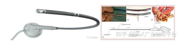 人工心脏5——一文浅析短期PVAD（下） - 知乎