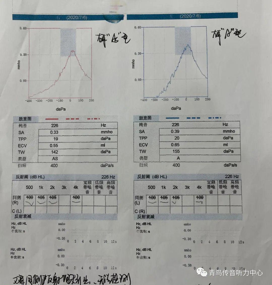 大前庭的案例分析和跟踪 知乎
