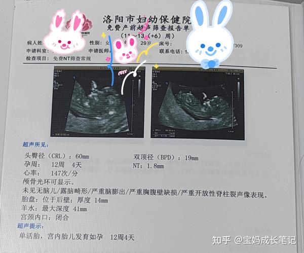 孕12周NT筛查B超单怎么看？ - 知乎