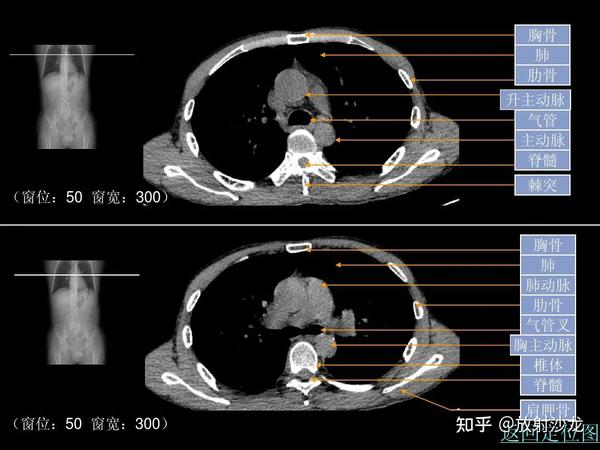 超细的腹部CT入门精美解剖图谱 - 知乎