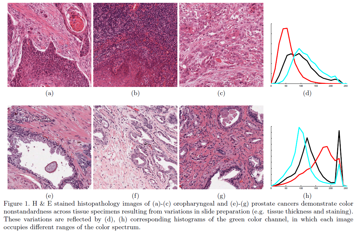 EM-based segmentation-driven color standardization - 知乎