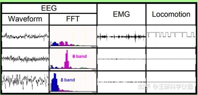 SleepSign 睡眠分析系统 - 知乎