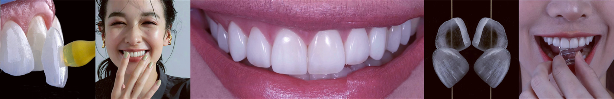 什么是口腔美学-DSD（Digital Smile Design）数字笑容？ - 知乎