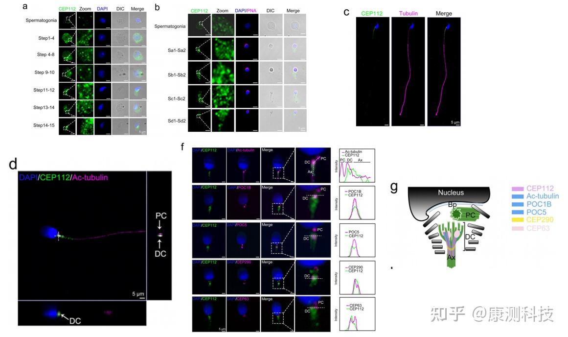 NC|男性不育新机制：CEP112突变损害相分离和必需生育mRNA的翻译 - 知乎