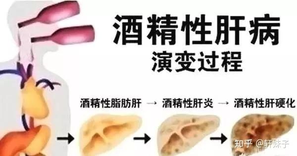 如果你的丈夫经常喝酒应酬 请你为他收藏这个护肝宝贝 知乎