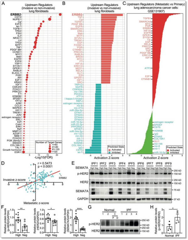 J Exp Med︱蒋典华团队揭示HER2是调控肺成纤维细胞侵袭和肺纤维化新靶点 - 知乎