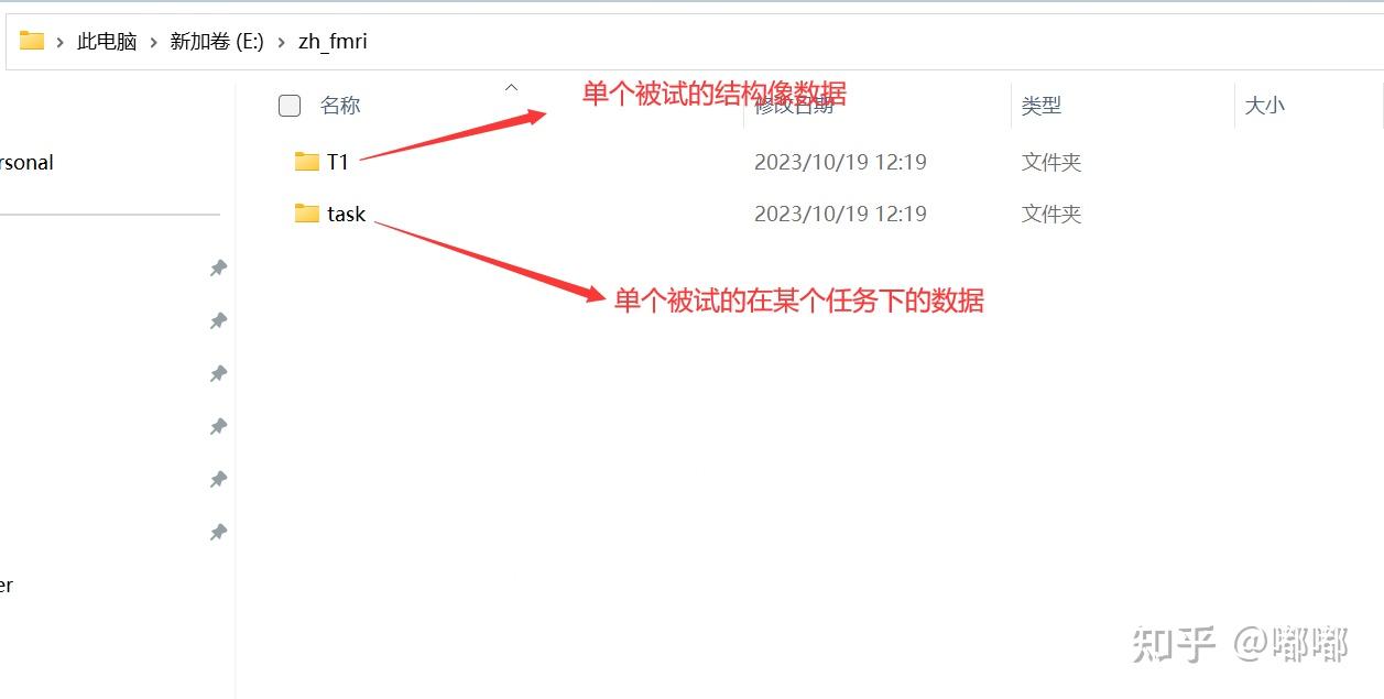 1-spm-fMRI任务态数据处理——格式转换 - 知乎