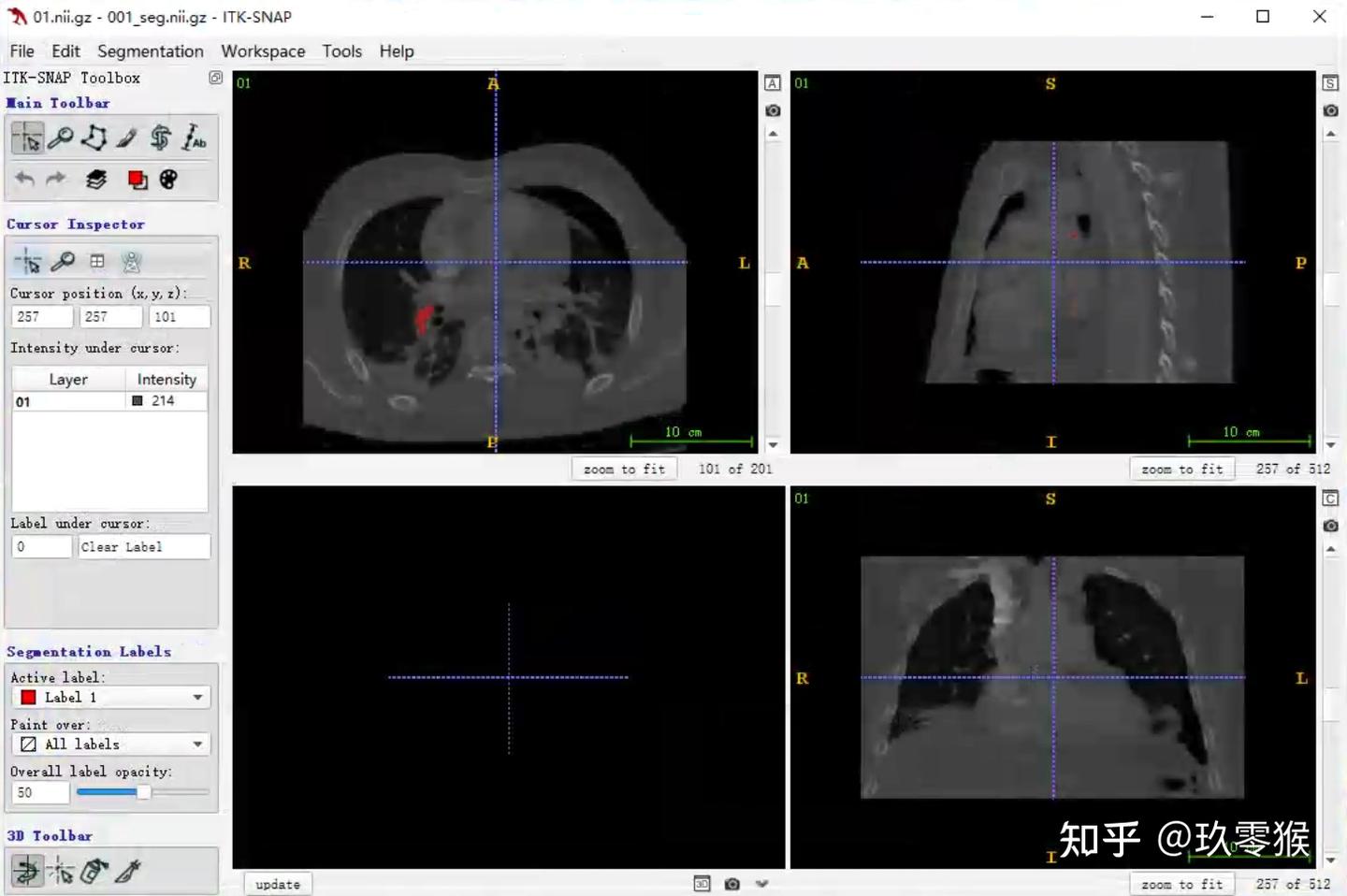 医学图像2D/3D可视化 ITK-SNAP软件使用 - 知乎