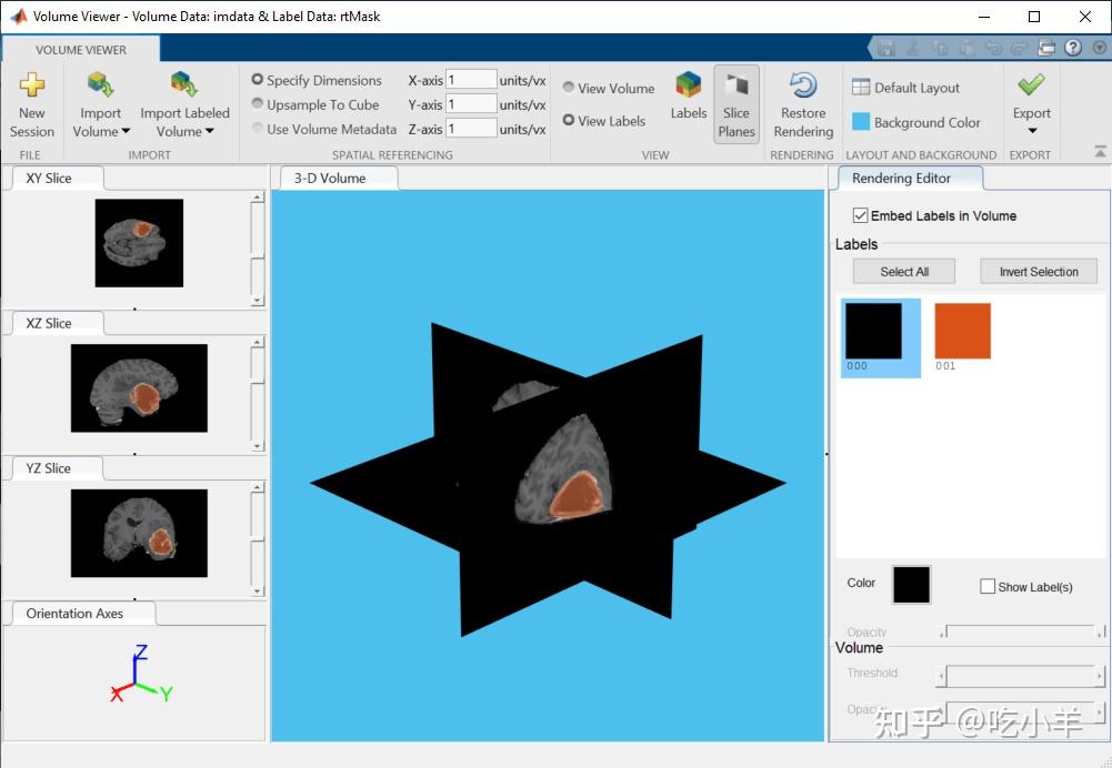 MATLAB图像处理：125：创建和显示 DICOM-RT 轮廓数据的 3-D 掩码