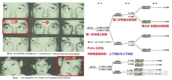 Parks三步法 - 知乎