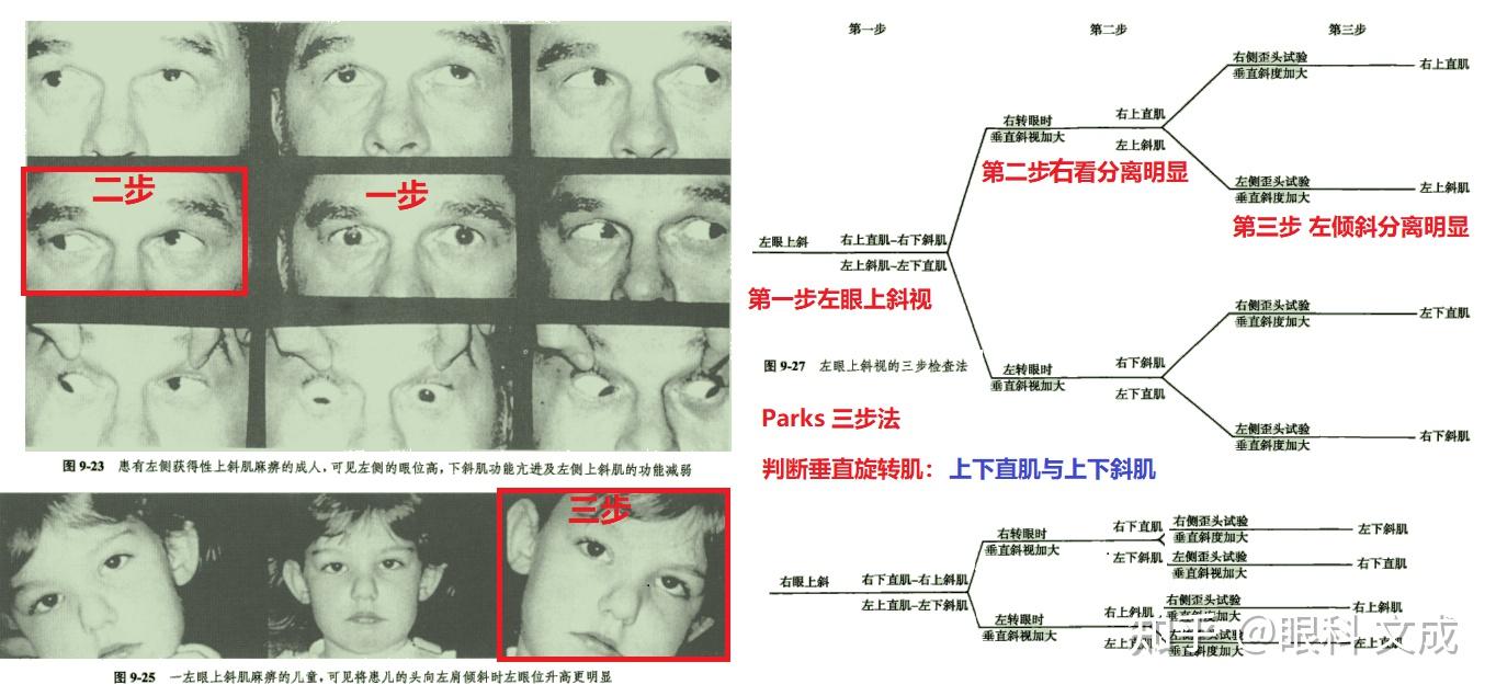 Parks三步法 - 知乎