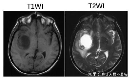 核磁共振原理(二)-成像方式 - 知乎