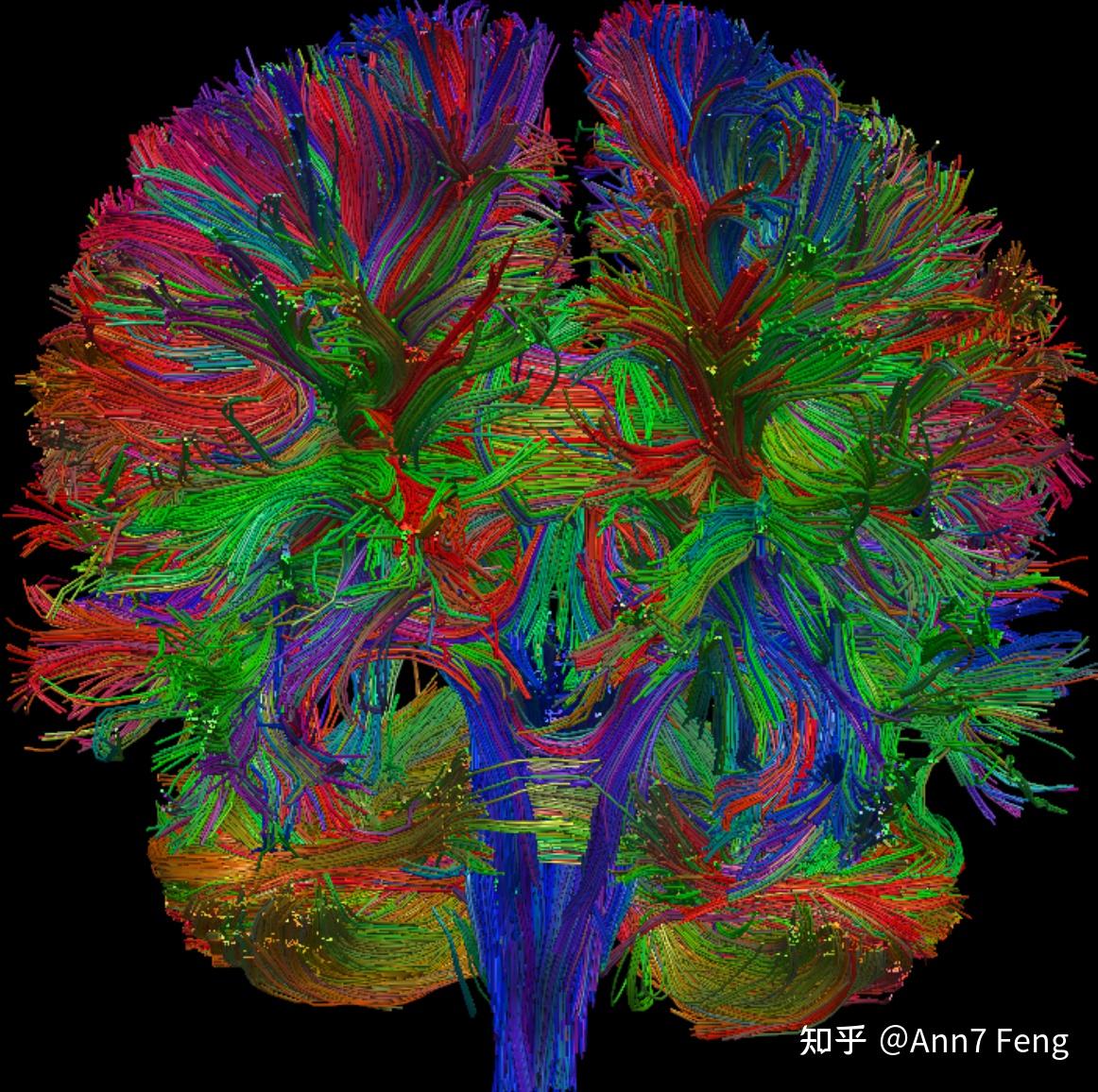 【Medical Imaging 01】 Diffusion Tensor Imaging (DTI) - 知乎