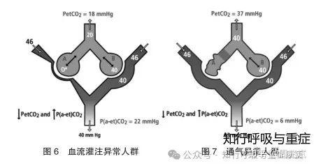 呼末二氧化碳监测原理、方法、影响因素及临床应用 第162期 - 知乎