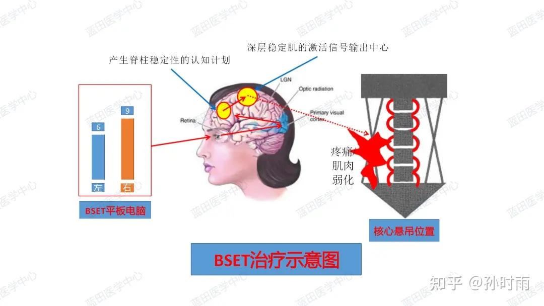 BSET生物反馈悬吊康复评估训练系统 - 知乎