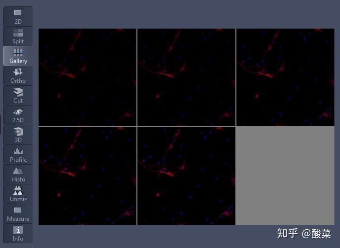 手把手教会荧光共定位分析 - 知乎