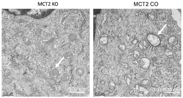 Int J Mol Sci｜多组学揭示MCT2限制肺癌小鼠模型中的肿瘤生长 - 知乎