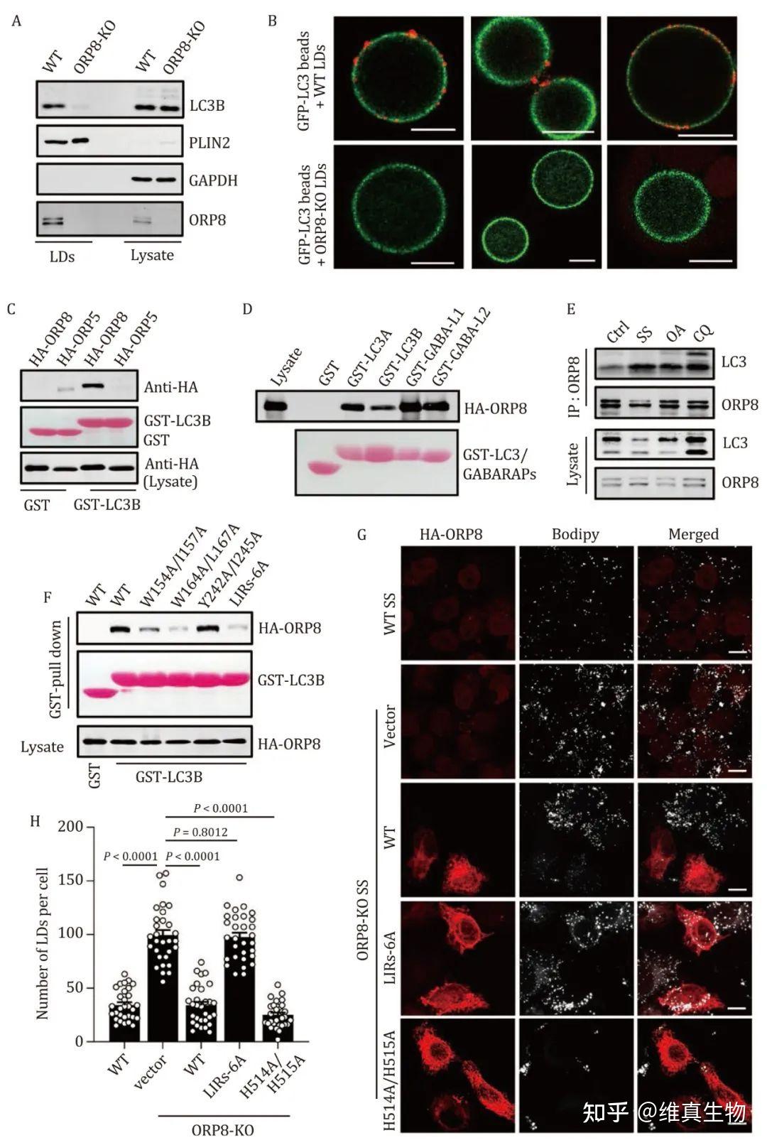 IF=15.328：浙大医学院刘伟/Dante Neculai团队合作揭示脂质转移蛋白ORP8在脂滴自噬中的关键作用 - 知乎