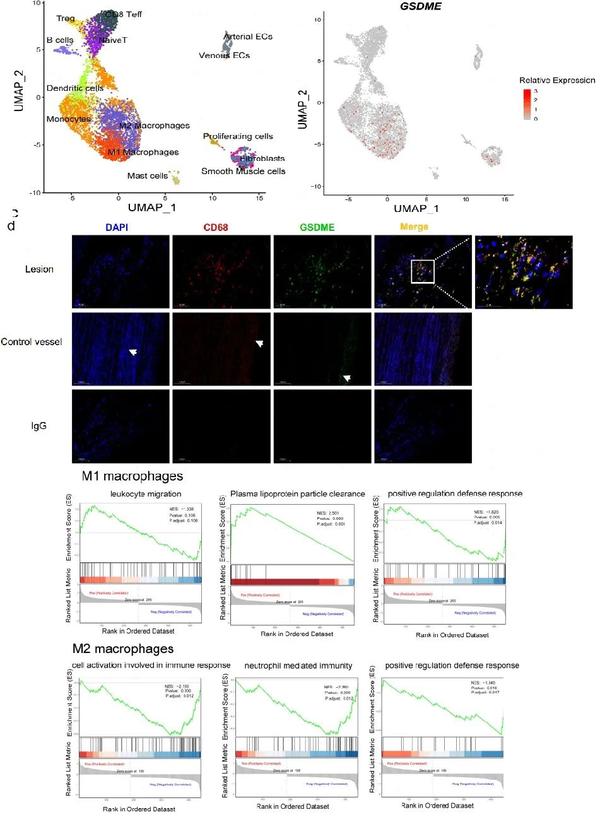 项目文章 | 单细胞测序揭示GSDME介导的细胞焦亡促进动脉粥样硬化进程 - 知乎