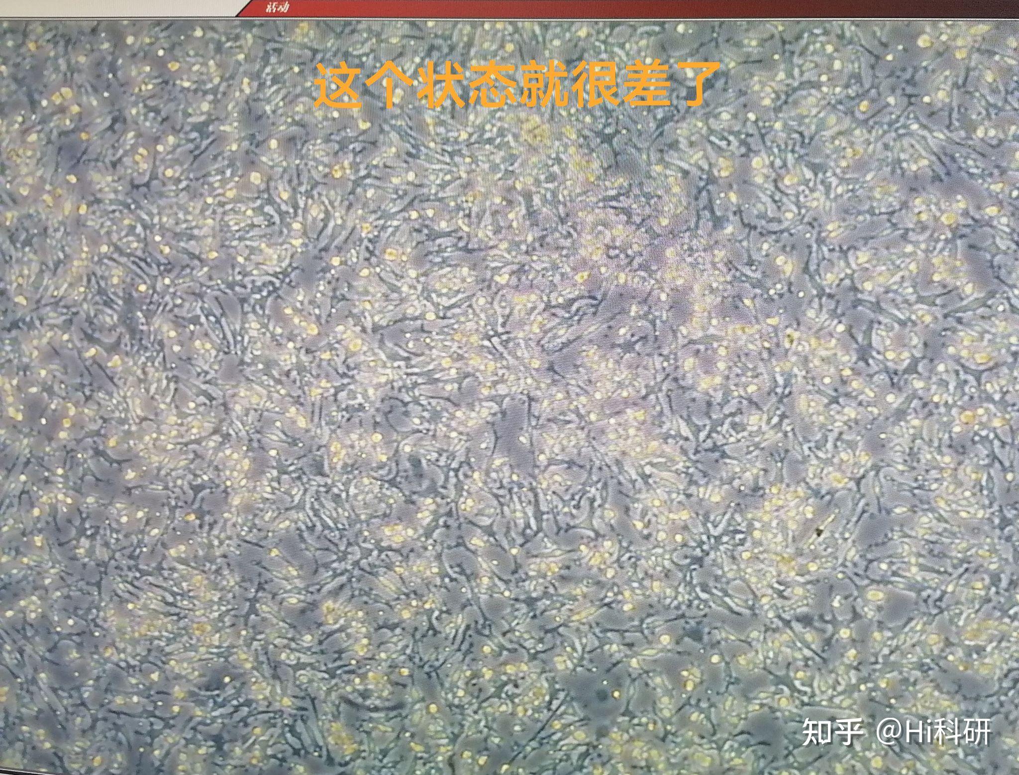 BMDM小鼠骨髓源性原代细胞培养 生物实验 研究生 - 知乎