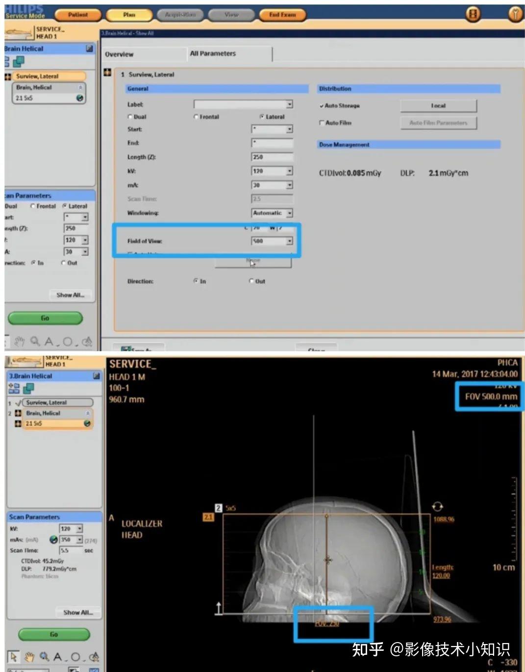 CT的扫描野和显示野 - 知乎