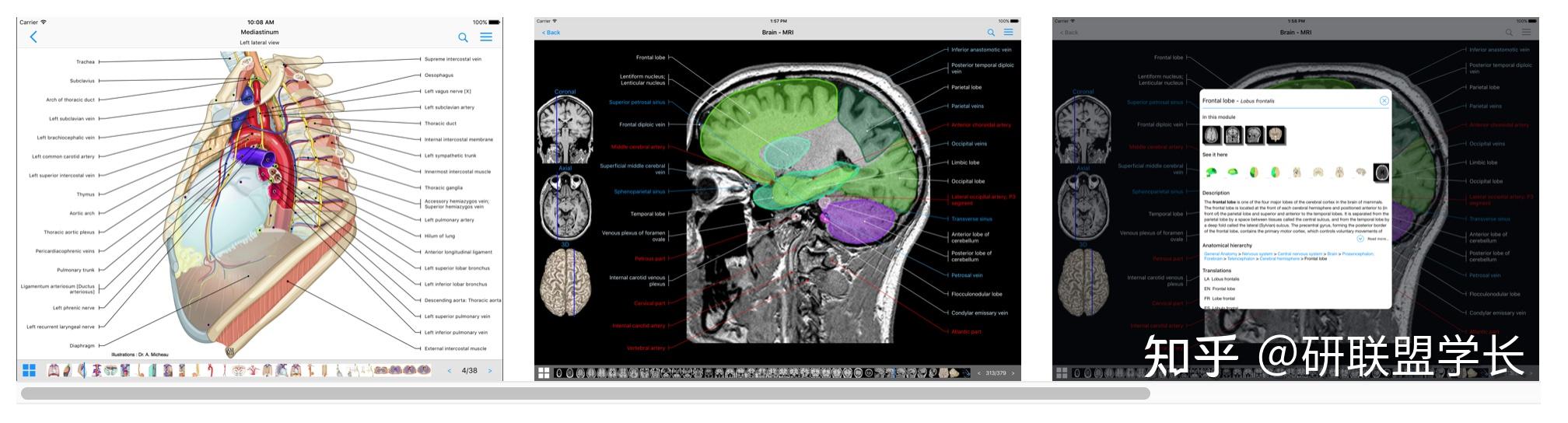 e-anatomy 一款爱不释手的影像软件 - 知乎