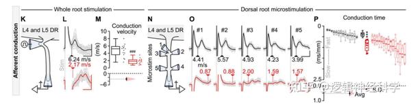 STM︱伦敦大学学院团队发现脊髓神经回路功能障碍介导的Dyt1-Tor1a肌张力障碍小鼠的病理发生机制 - 知乎