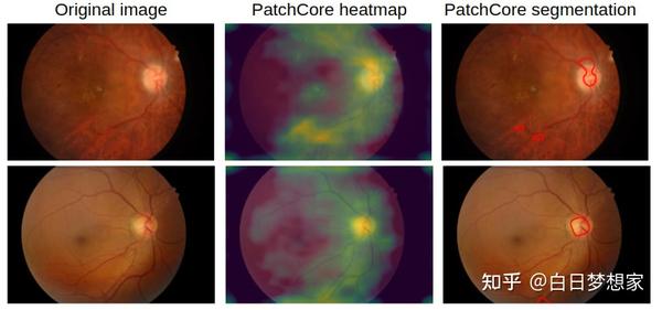 使用 Anomalib 进行异常检测的实用指南 - 知乎