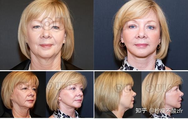 ACMETEA科普课堂：微拉美是什么，微拉美是怎么做的！ - 知乎