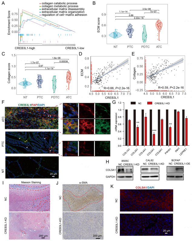 【IF=41】单细胞技术揭秘CREB3L1促进间变性甲状腺癌的生长和转移 - 知乎
