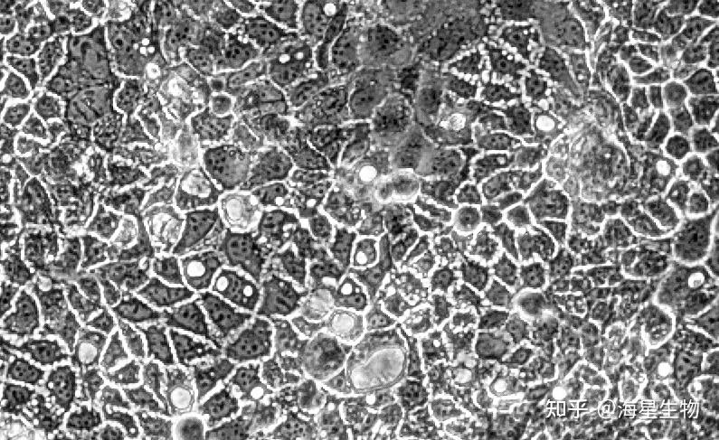人结直肠腺癌细胞(Caco-2)培养要点 - 知乎