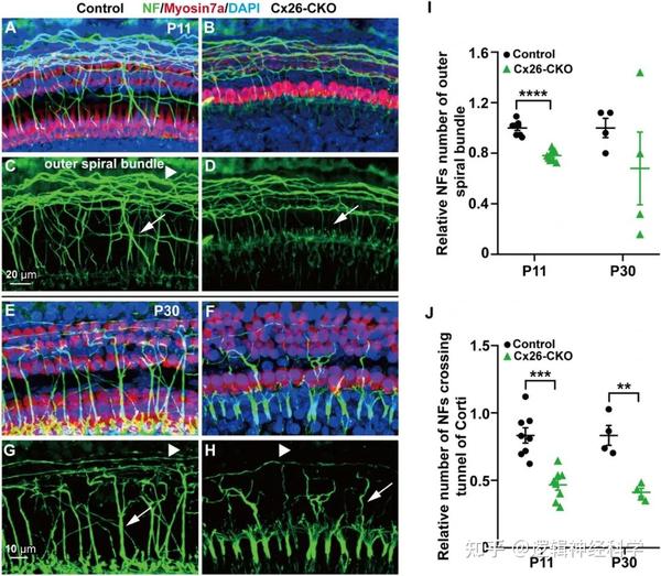 Neurosci Bull︱华中科技大学孙宇团队建立新的Cx26条件敲除小鼠模型，揭示Gjb2敲除小鼠外周听觉系统的病理生理改变 - 知乎